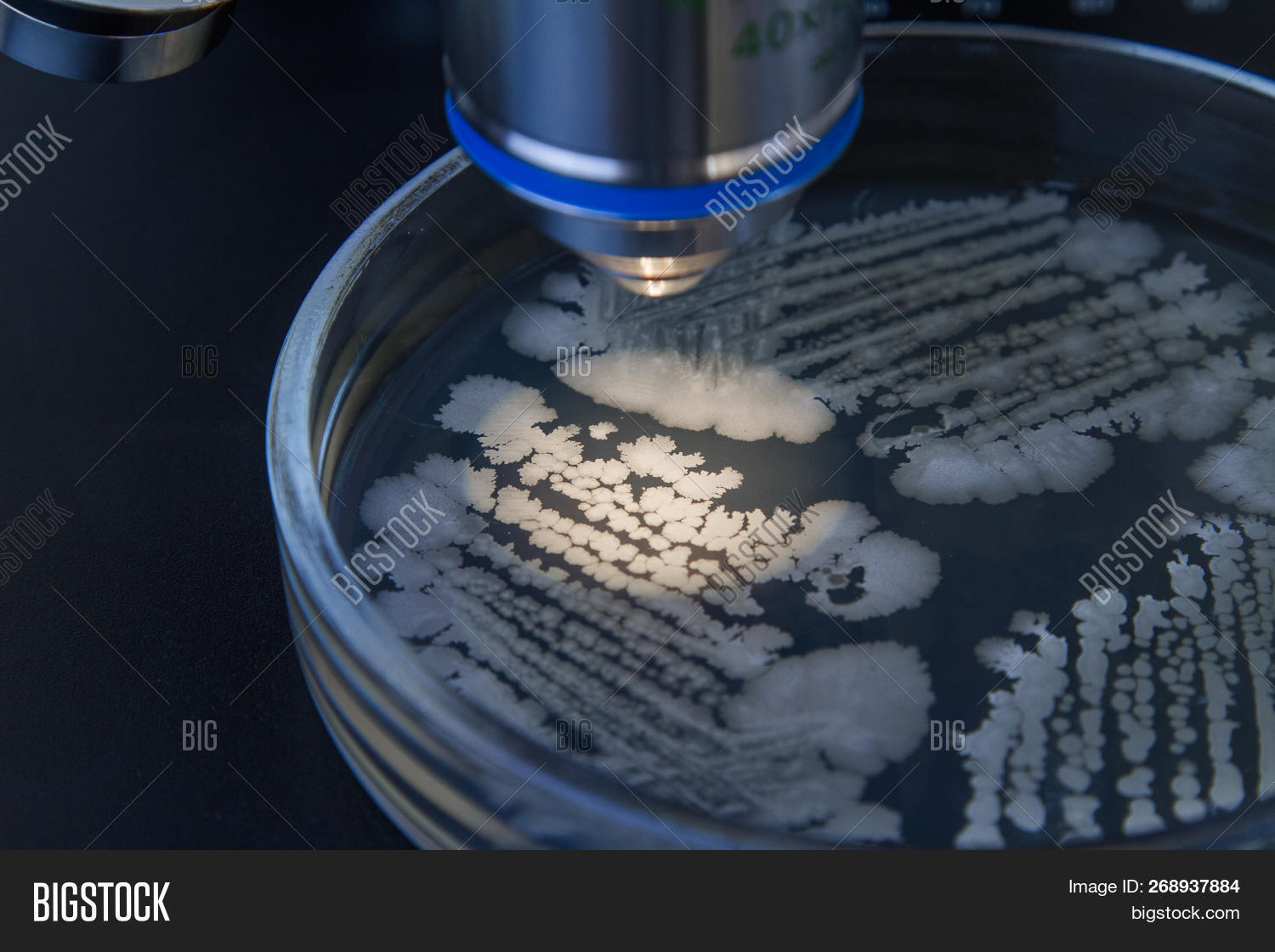 Close- Colony Bacteria Image & Photo (Free Trial) | Bigstock