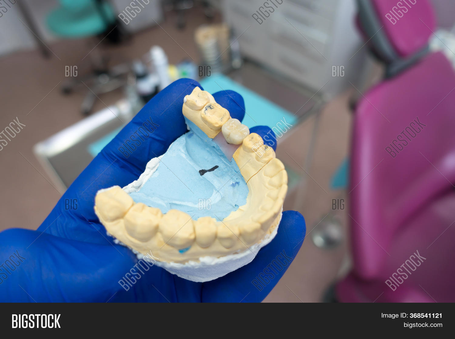Close- Ceramic Tooth Image & Photo (Free Trial) | Bigstock