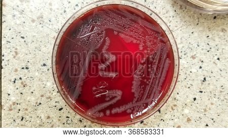 Blood Agar Culture Image & Photo (Free Trial) | Bigstock