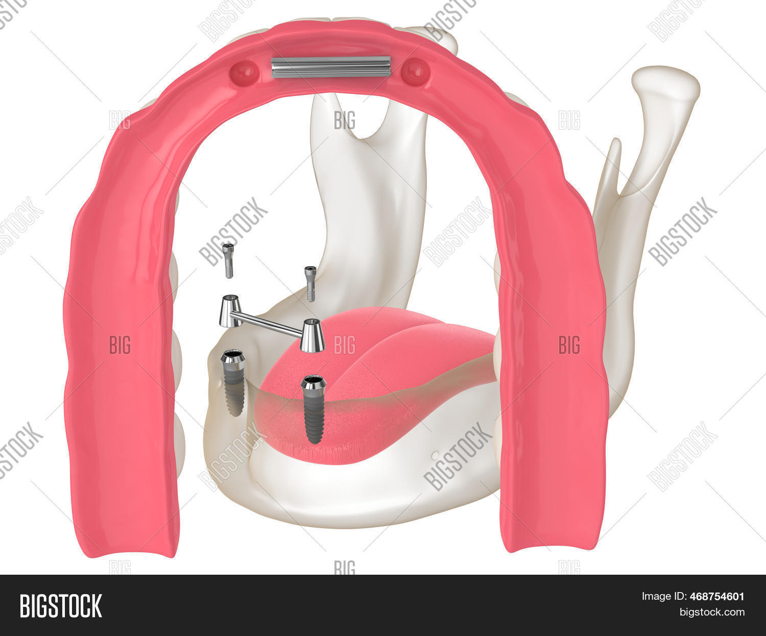 3d Render Removable Image & Photo (Free Trial) | Bigstock