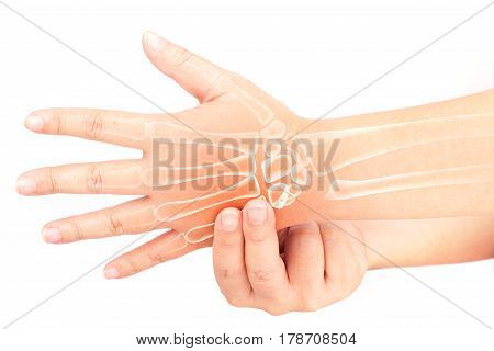 Hand Bones Injury Image & Photo (Free Trial) | Bigstock