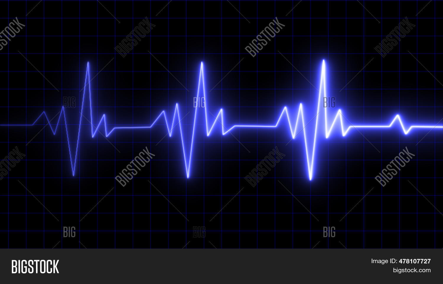 Ekg Monitoring Image & Photo (Free Trial) | Bigstock