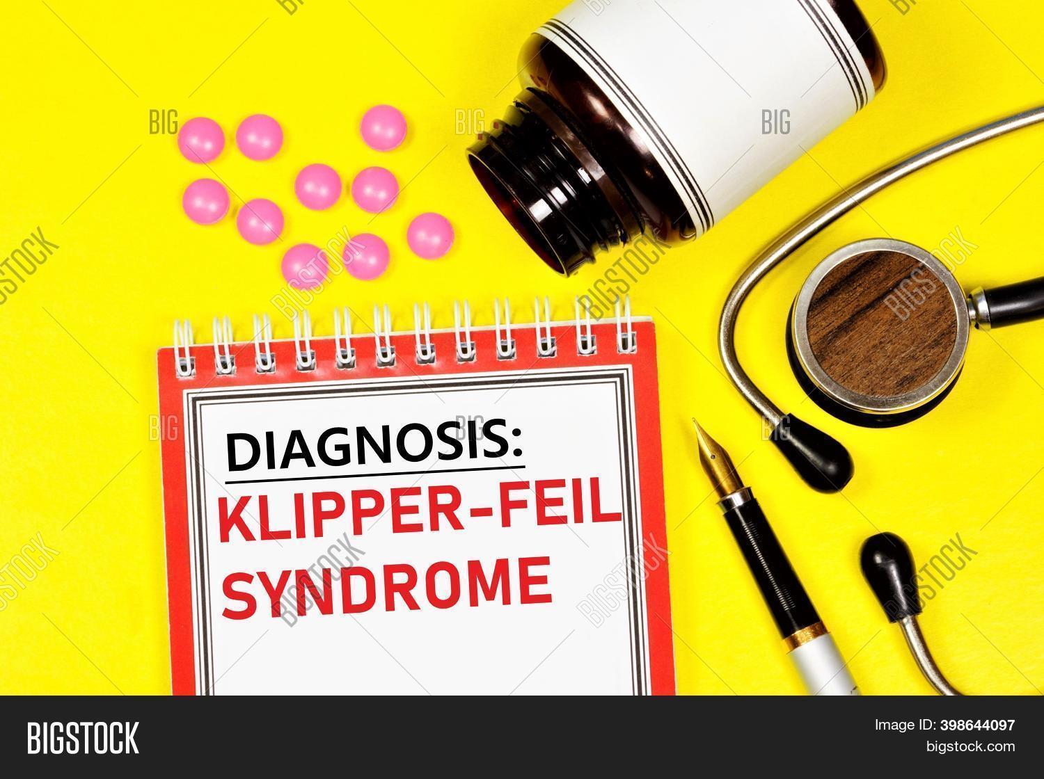 Klipper-feil Sindrome Image & Photo (Free Trial) | Bigstock