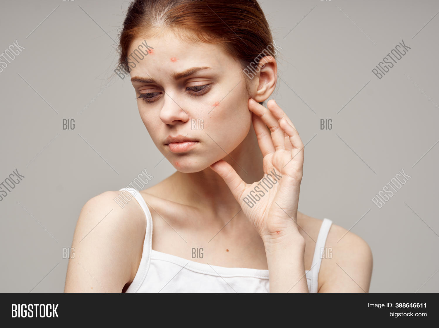Woman Face Skin Image & Photo (Free Trial) | Bigstock