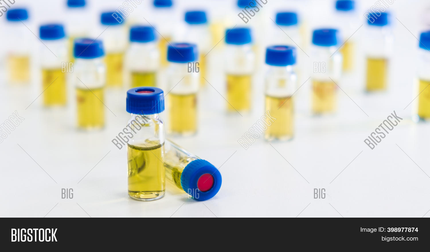 Test Tubes Urine Image & Photo (Free Trial) | Bigstock