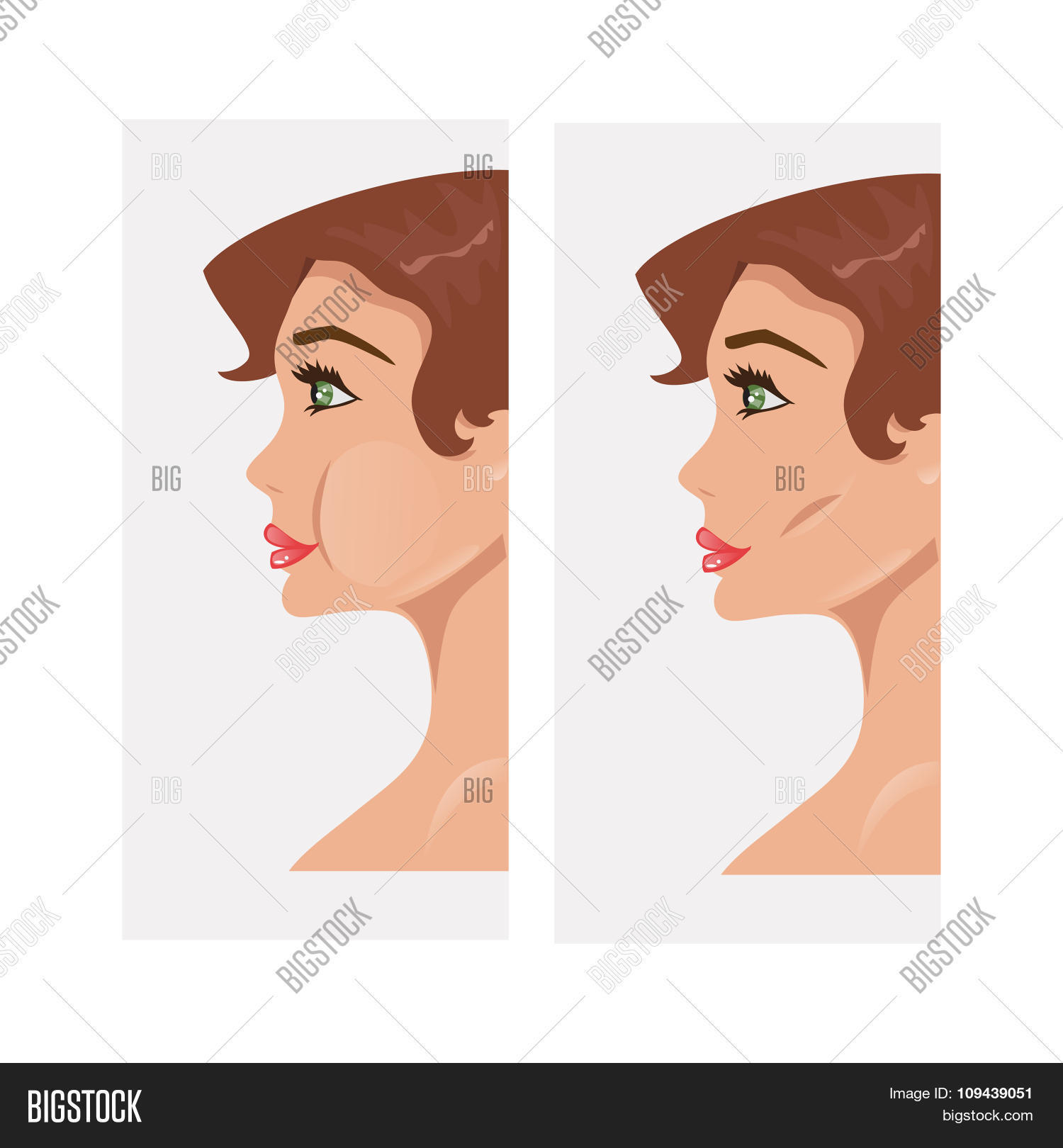 Plastic Cheekbones. Vector & Photo (Free Trial) | Bigstock
