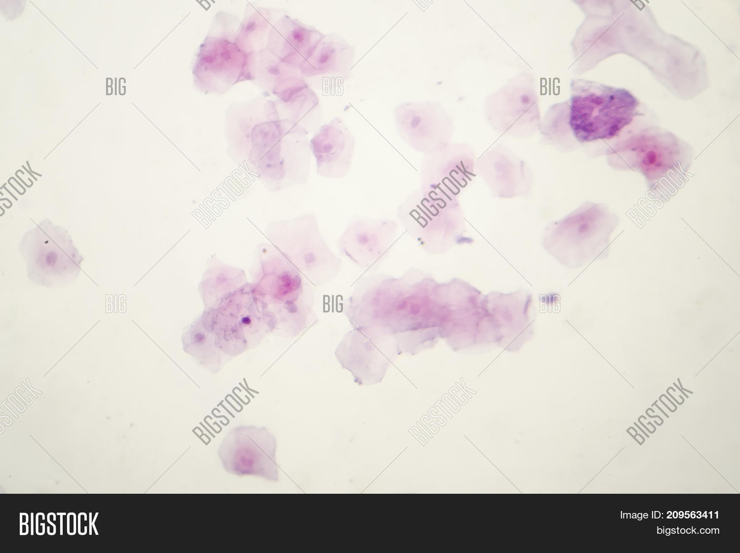Human Buccal Smear Image & Photo (Free Trial) | Bigstock