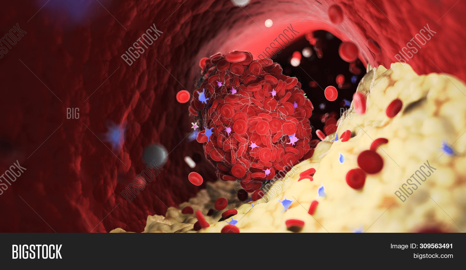 3d Rendered Medically Image & Photo (Free Trial) | Bigstock