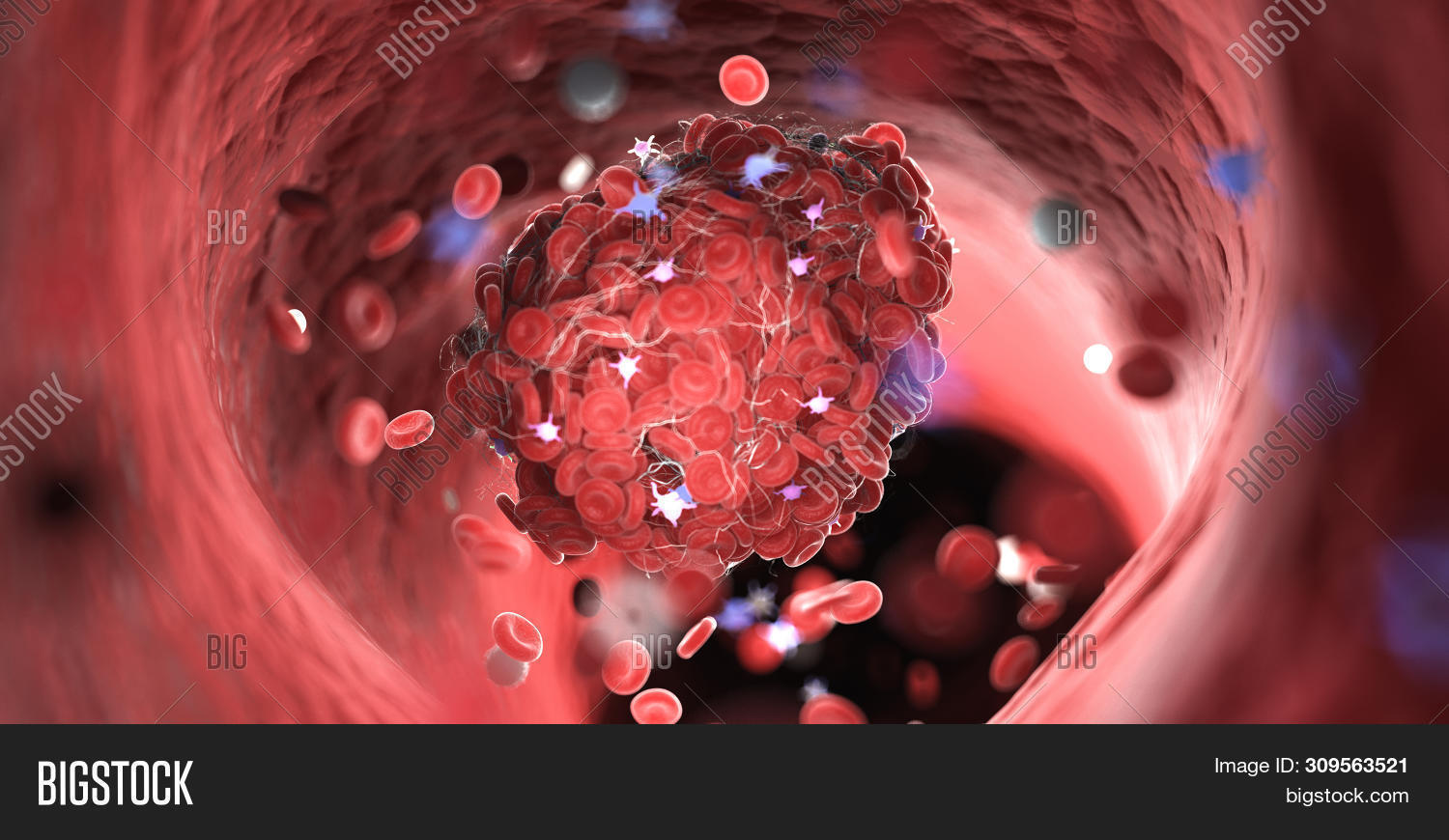 3d Rendered Medically Image & Photo (Free Trial) | Bigstock