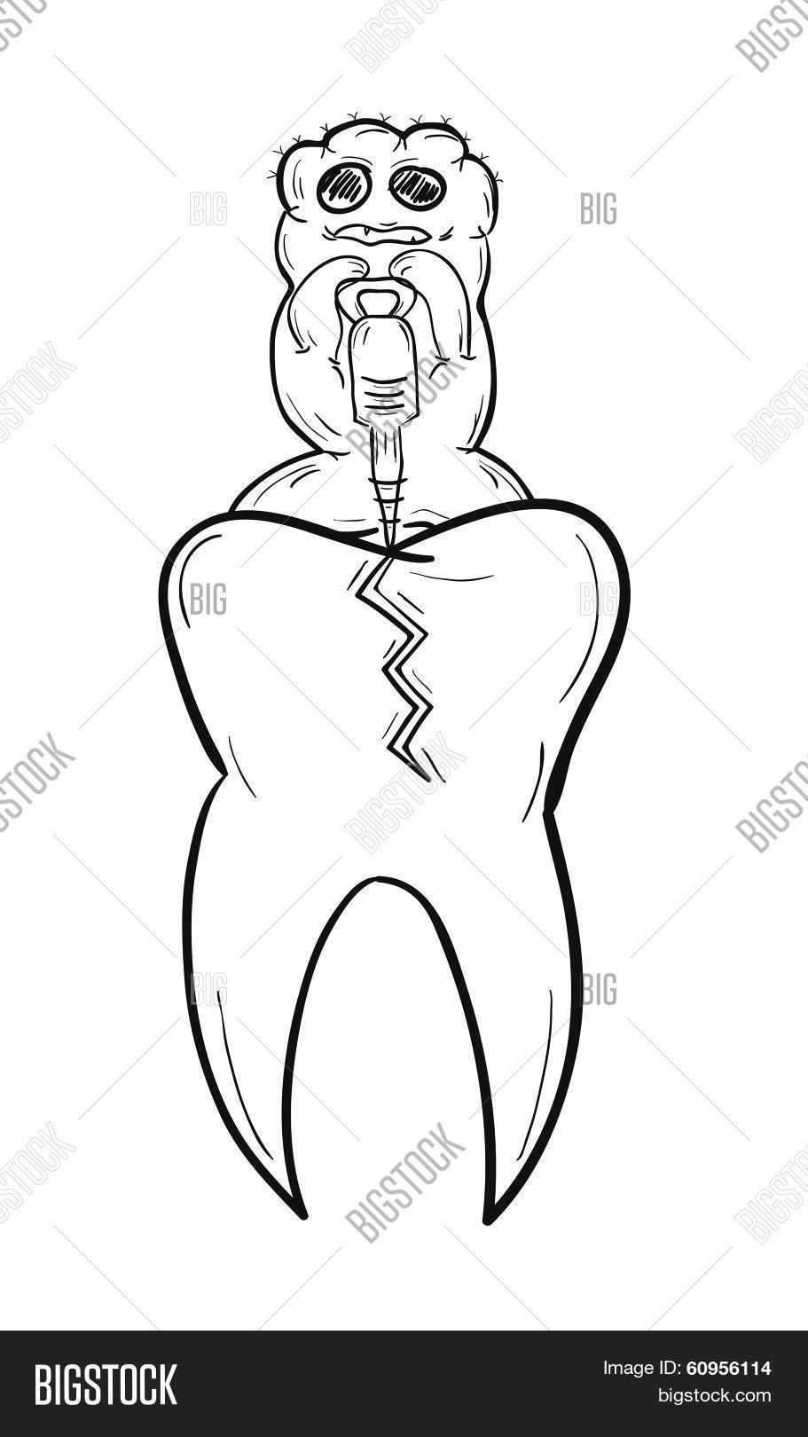 Sketch Tooth Defect Vector & Photo (Free Trial) | Bigstock