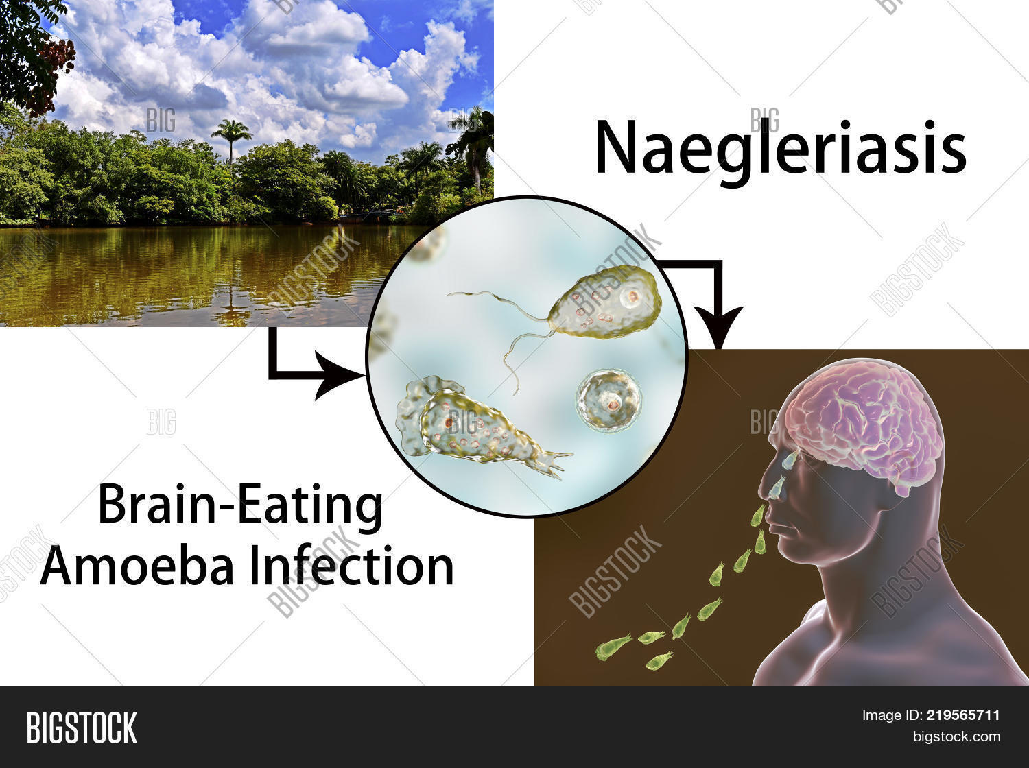Brain-eating Amoeba Image & Photo (Free Trial) | Bigstock