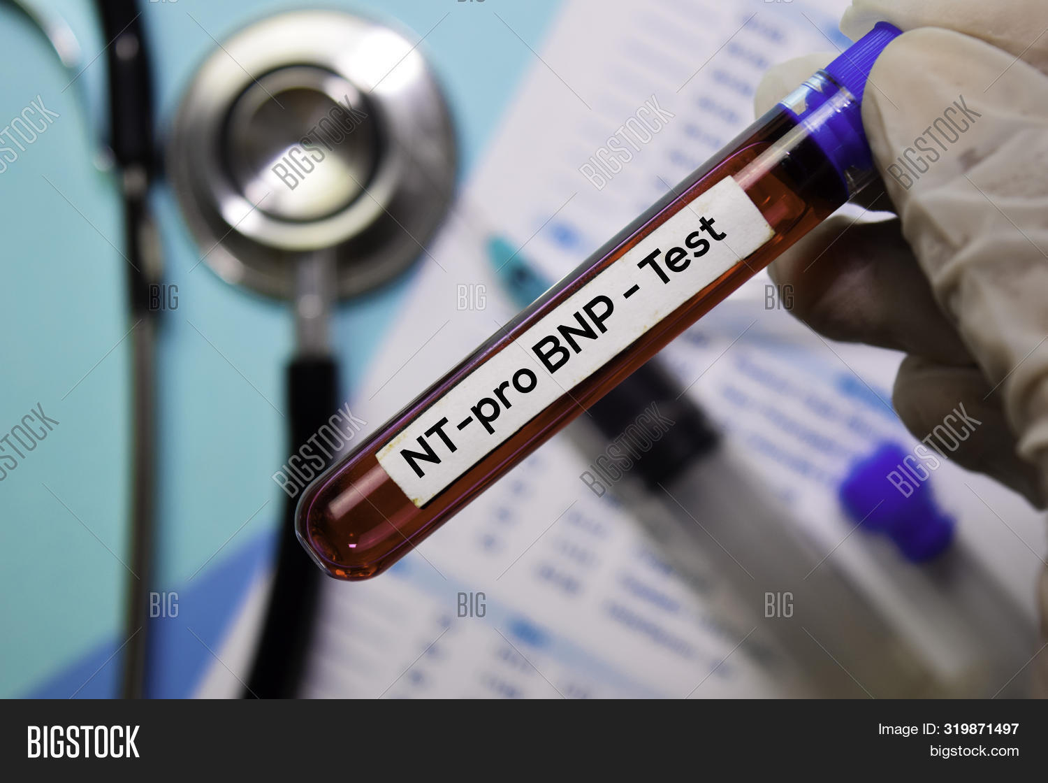 Nt-pro Bnp - Test Image & Photo (Free Trial) | Bigstock