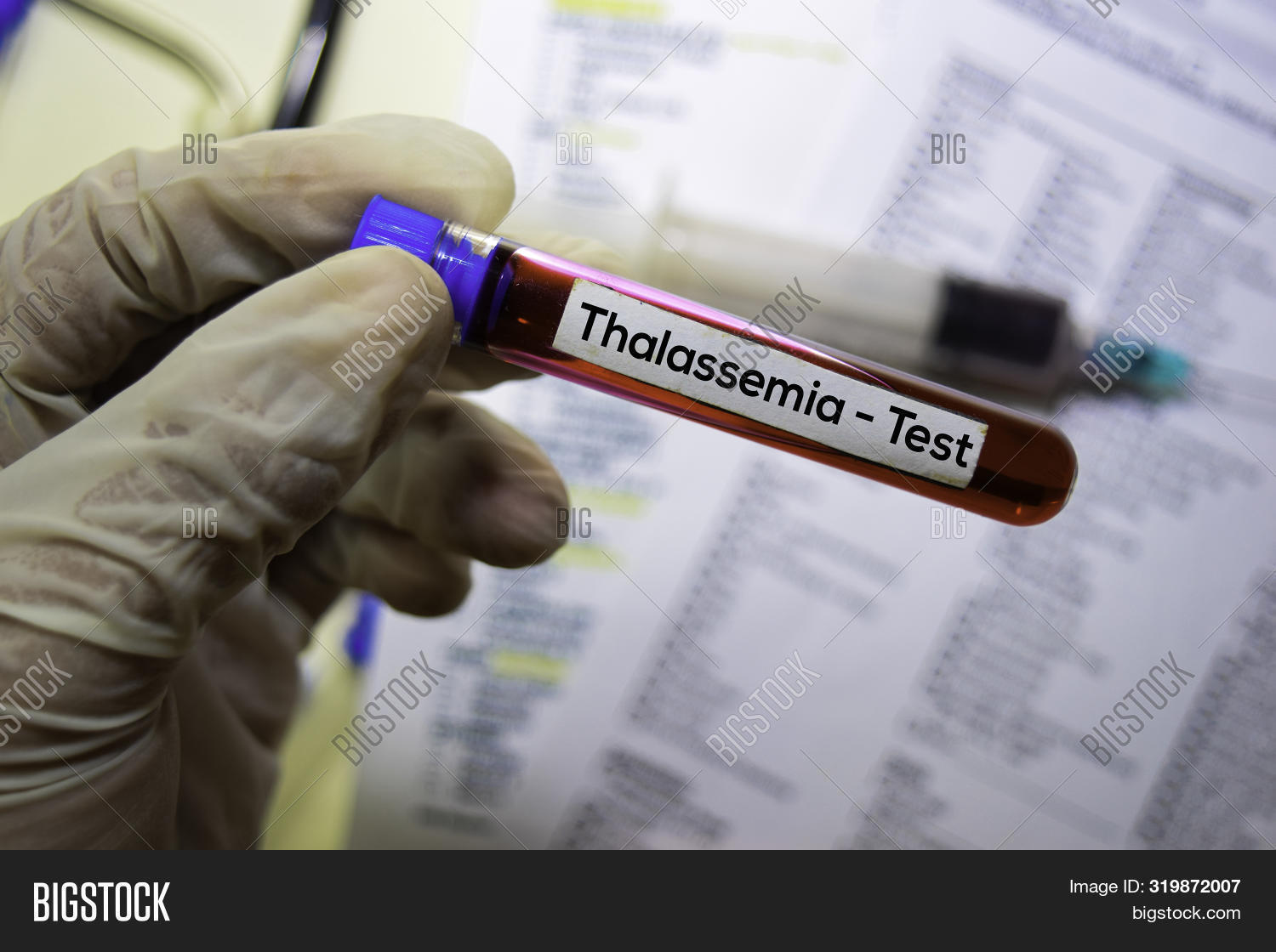 Thalassemia - Test Image & Photo (Free Trial) | Bigstock