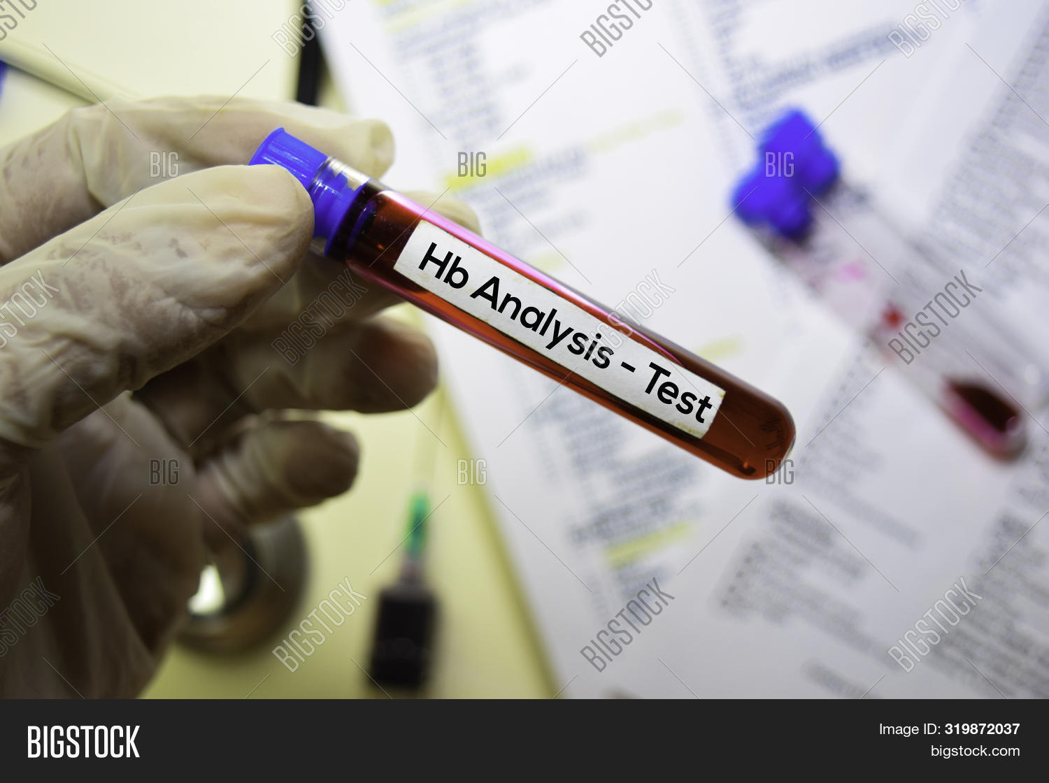 Hb Analysis - Test Image & Photo (Free Trial) | Bigstock