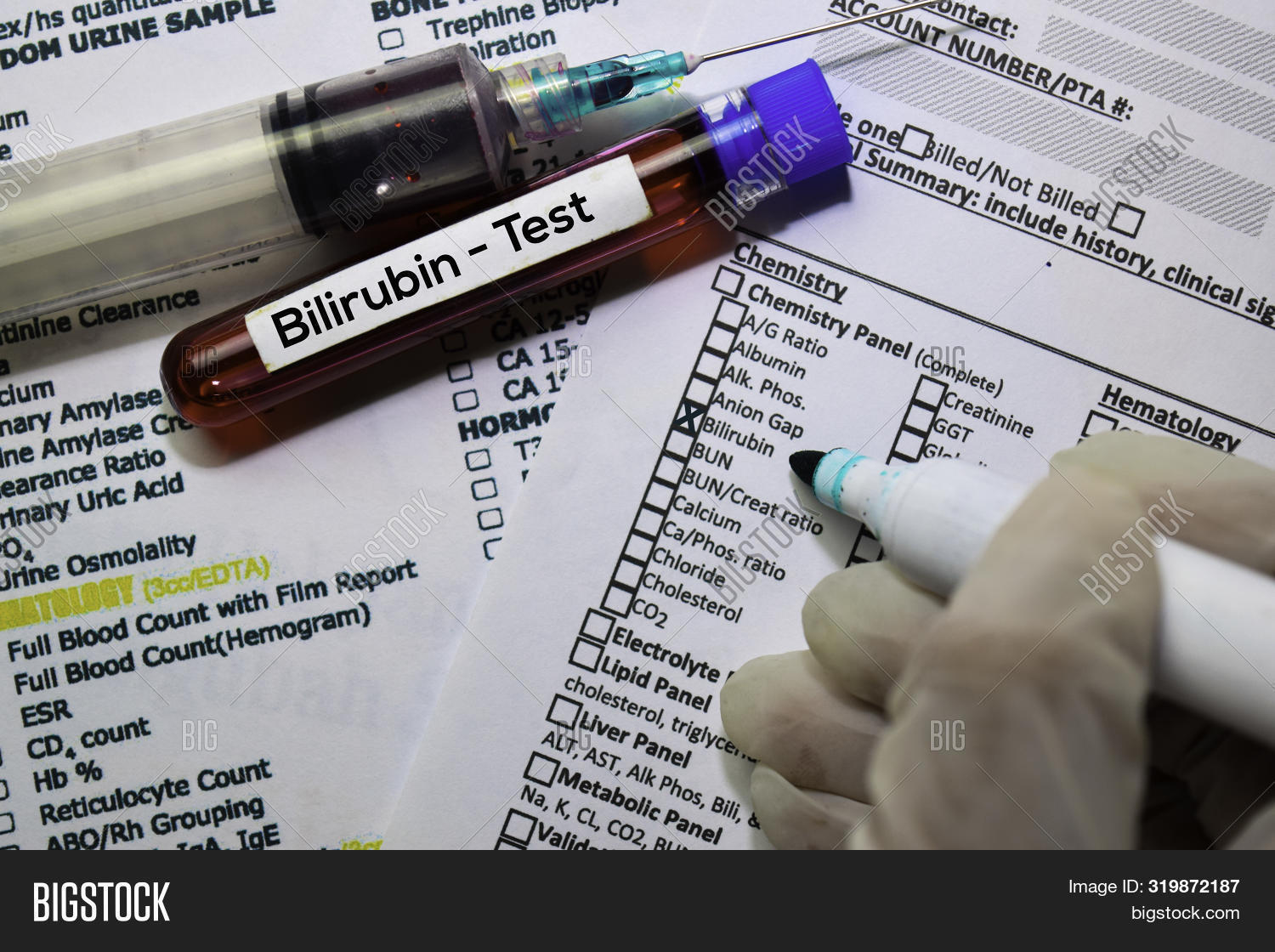 Bilirubin - Test Blood Image & Photo (Free Trial) | Bigstock