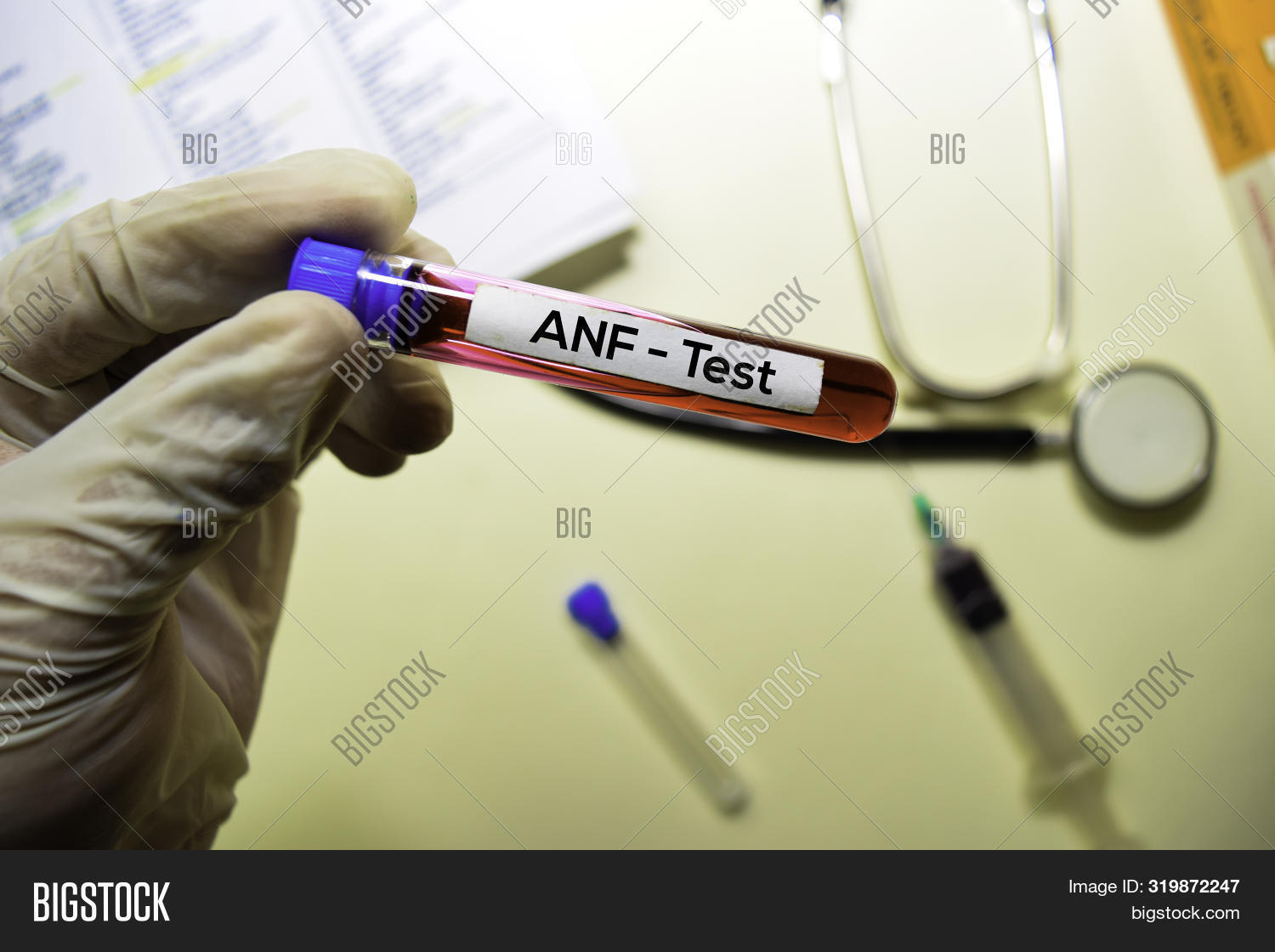 Anf - Test Blood Image & Photo (Free Trial) | Bigstock