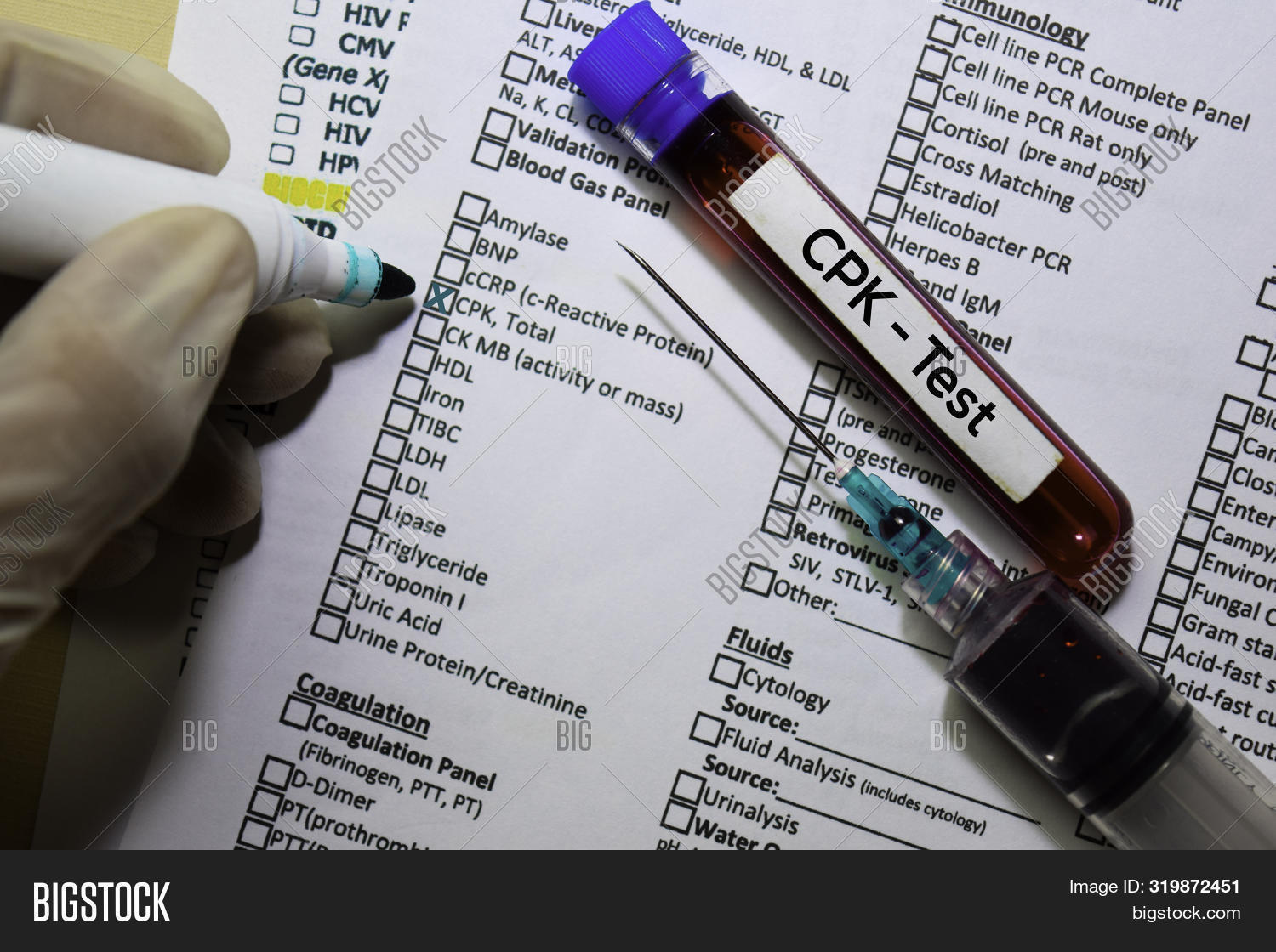Cpk - Test Blood Image & Photo (Free Trial) | Bigstock