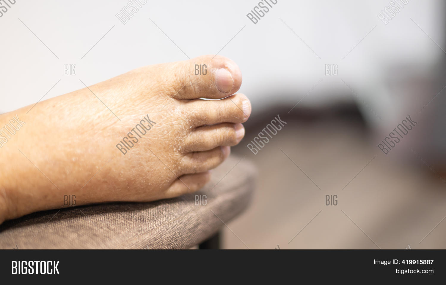 Feet Old Man Wrinkle Image & Photo (Free Trial) | Bigstock