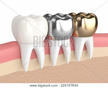 3D Render Teeth Image & Photo (Free Trial) | Bigstock