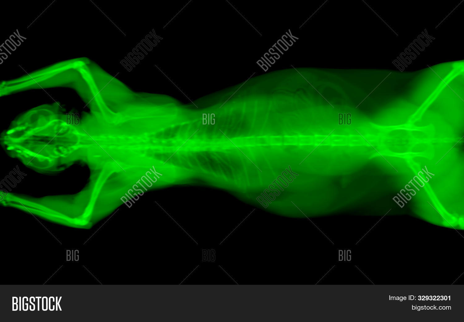 Green Ct Scan 图片和照片（免费试用） | Bigstock