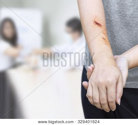 Wound Form Scabs On Image & Photo (Free Trial) | Bigstock