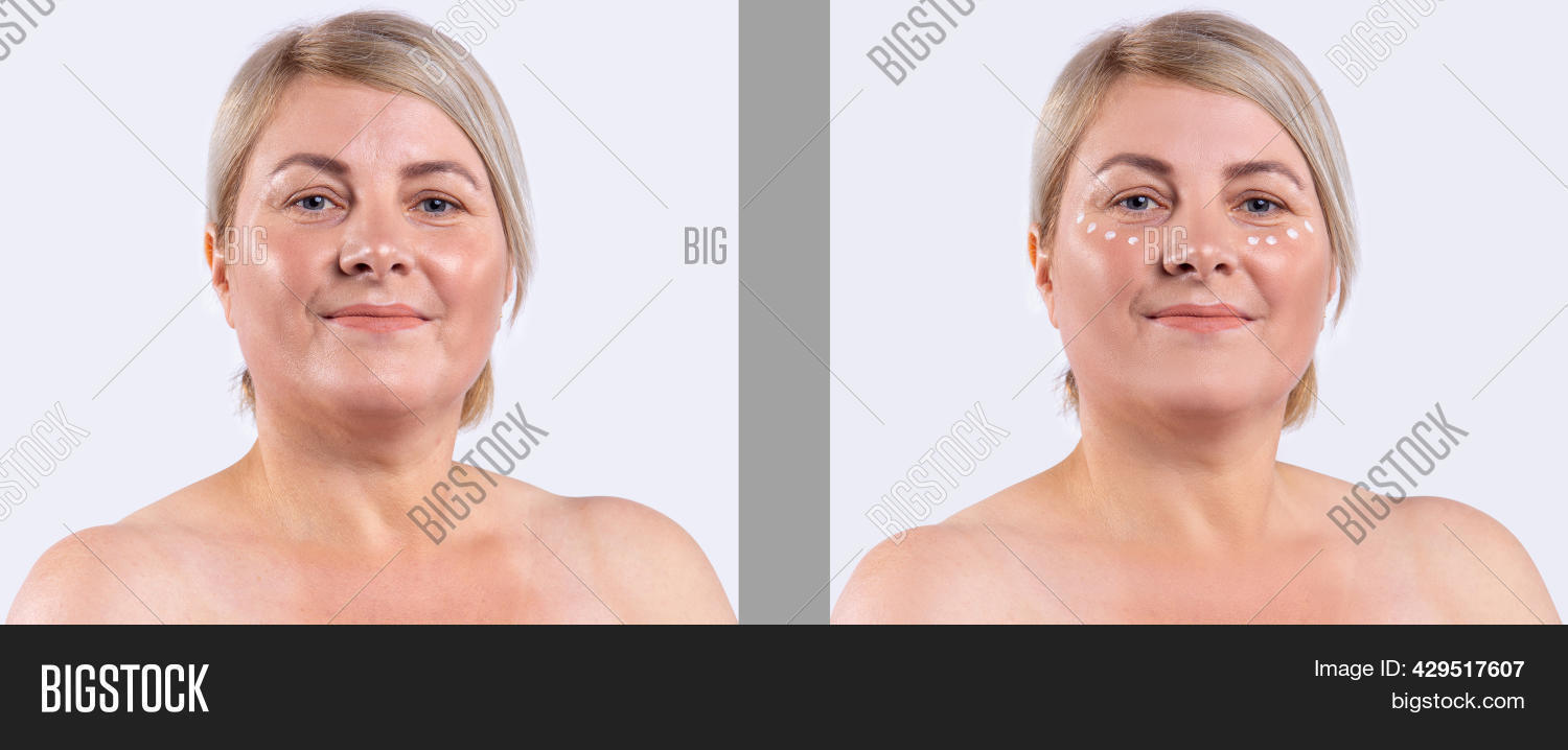 Two Opposite 图片和照片（免费试用） | Bigstock