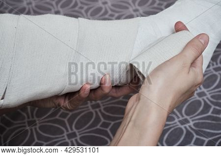 Broken Leg Cast Images, Illustrations & Vectors (Free) - Bigstock