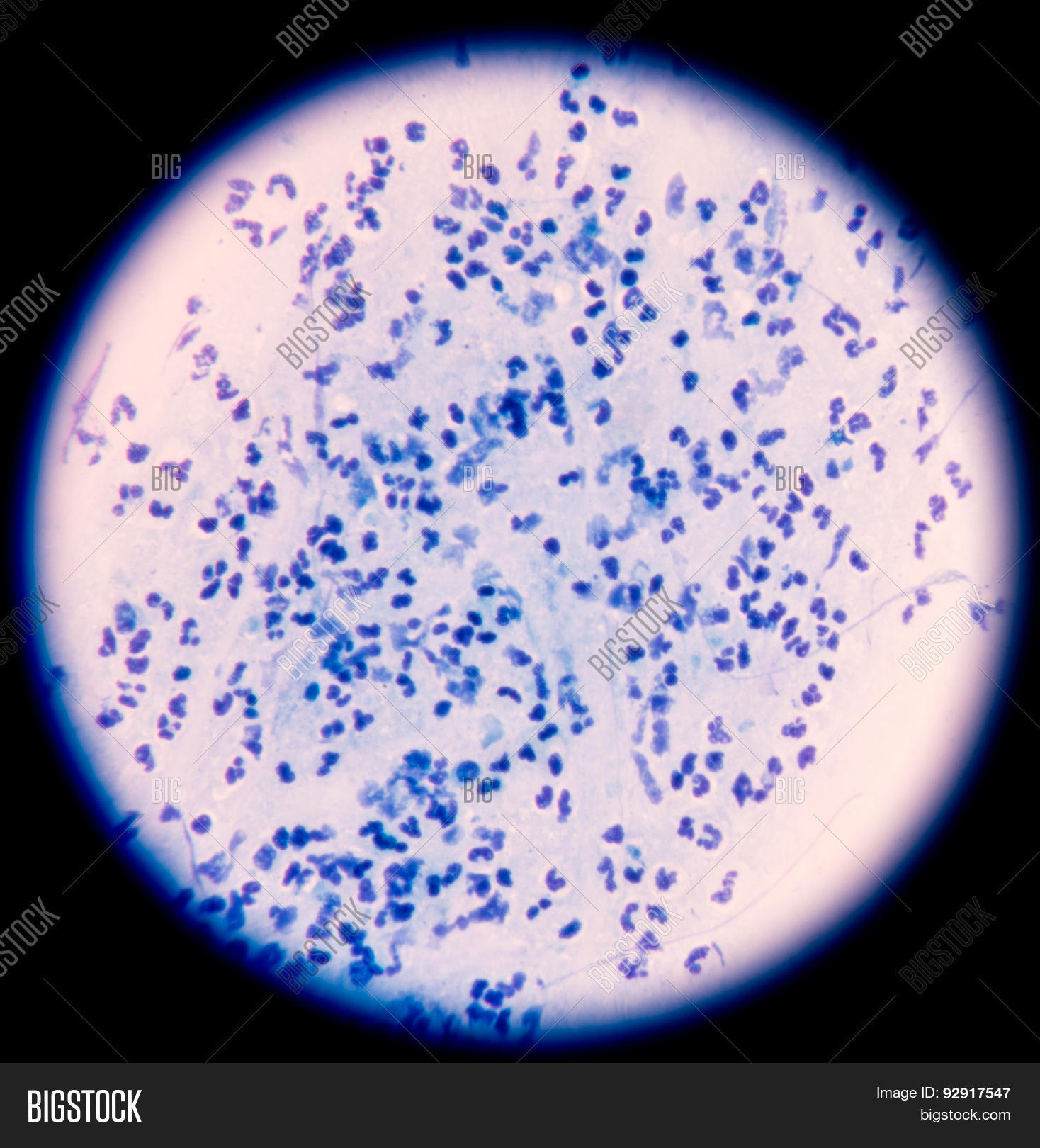 Slide Sputum Afb Image & Photo (Free Trial) | Bigstock