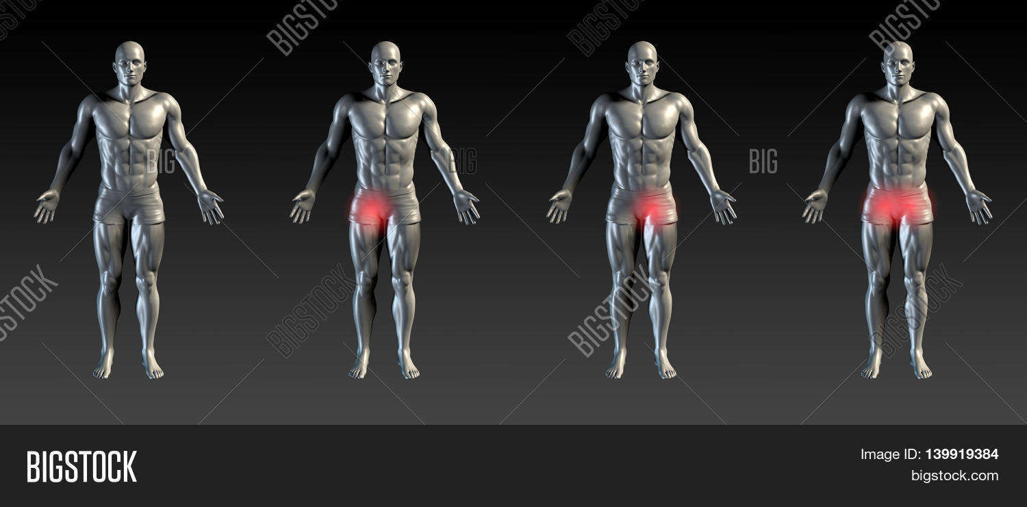 Groin Injury Red Glow Image & Photo (Free Trial) | Bigstock