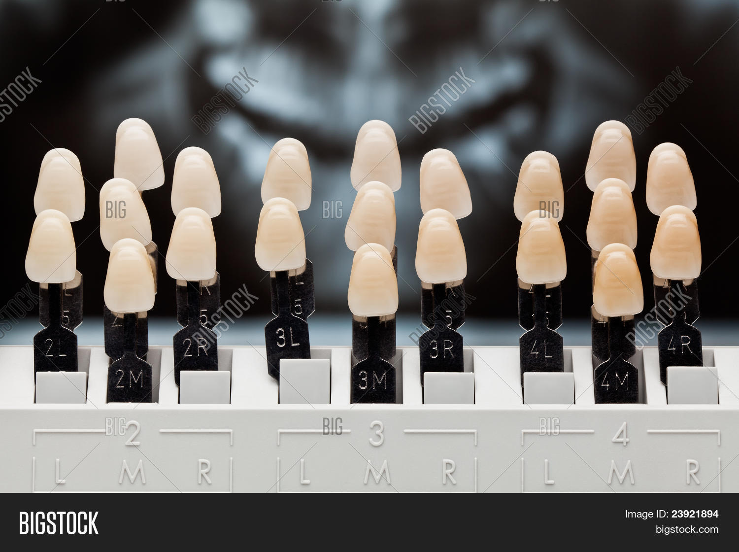Dental Teeth Shades Image & Photo (Free Trial) | Bigstock