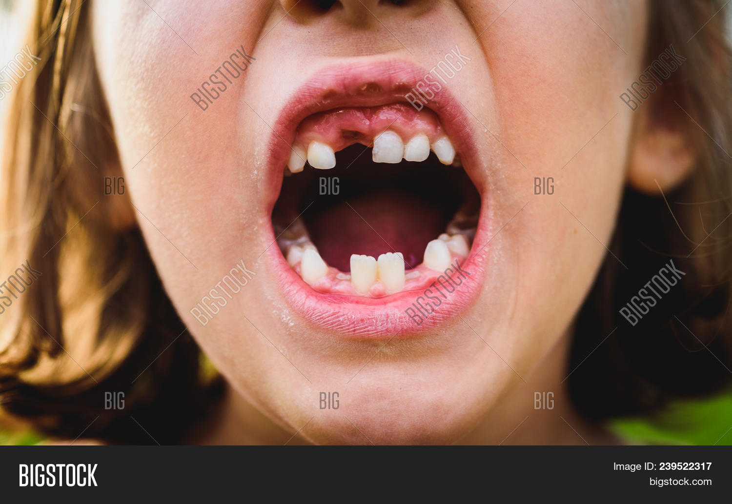 Portrait Toothless Image & Photo (Free Trial) | Bigstock
