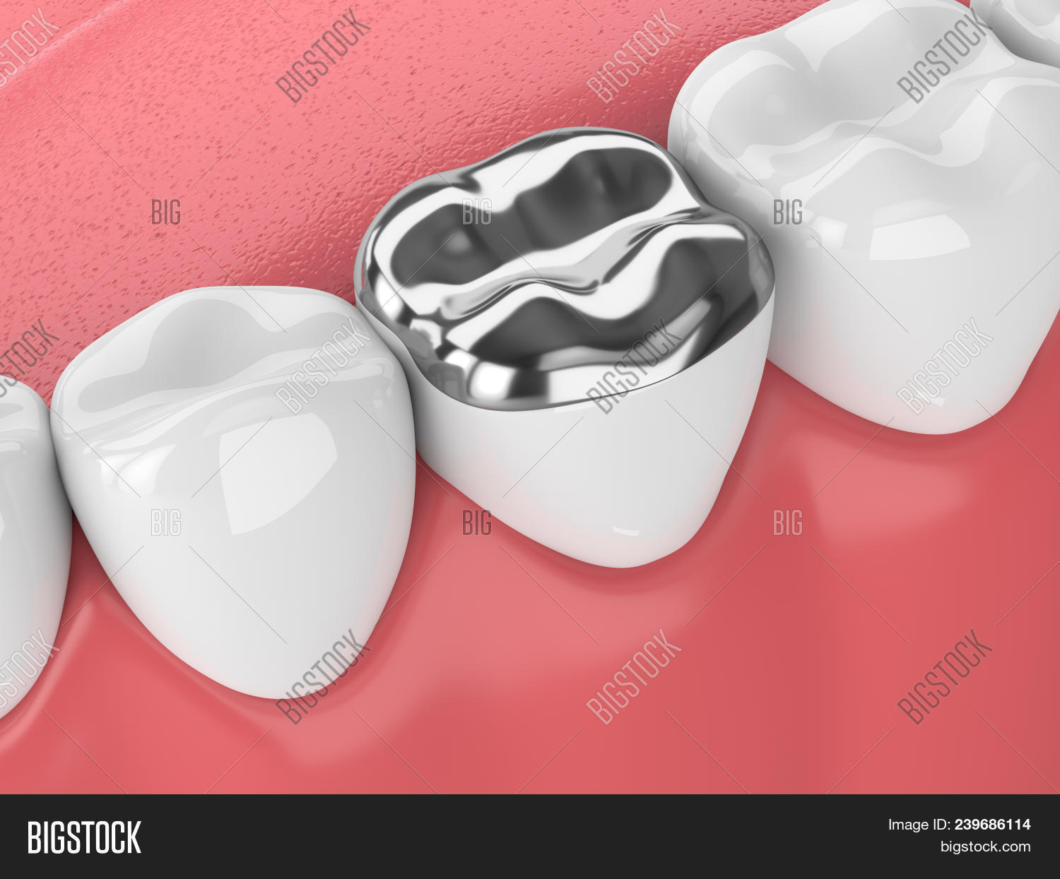 3D Render Teeth Dental Image & Photo (Free Trial) | Bigstock