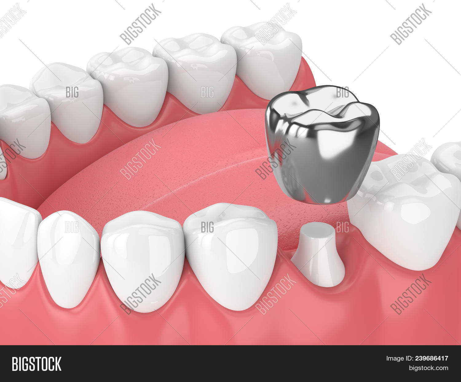 3D Render Teeth Dental Image & Photo (Free Trial) | Bigstock