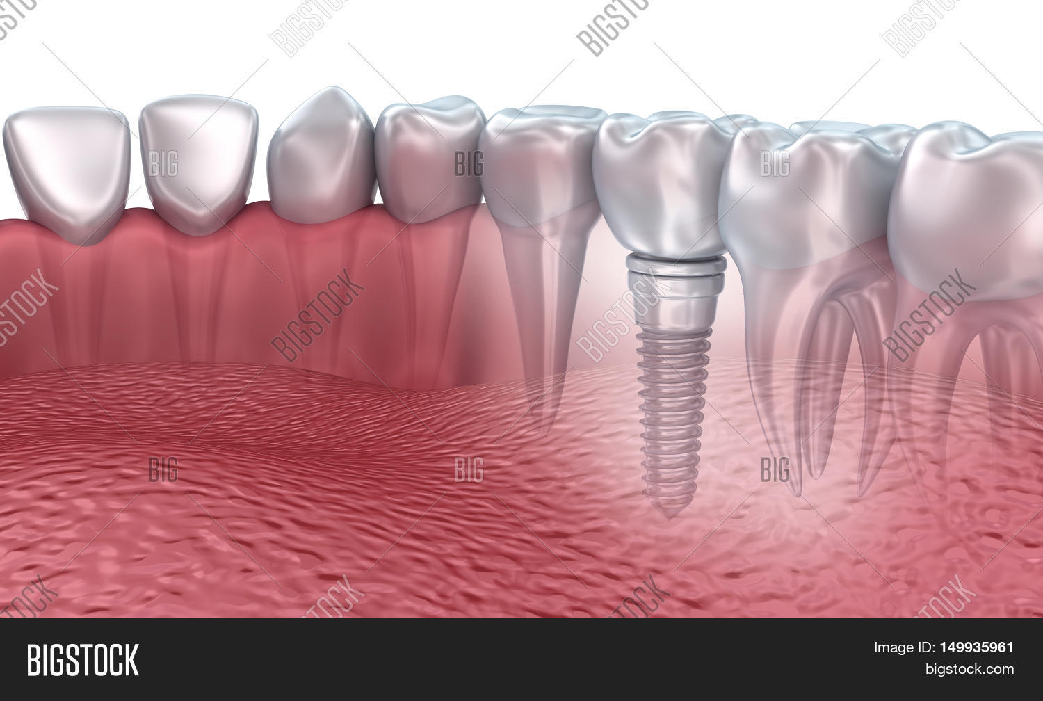 3d Lower Teeth Dental Image & Photo (Free Trial) | Bigstock