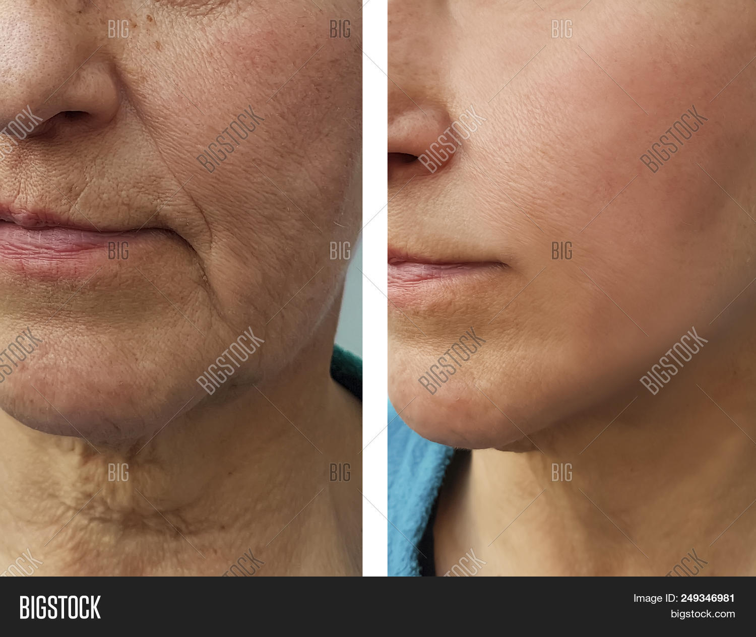 Wrinkles Woman Face Image & Photo (Free Trial) | Bigstock