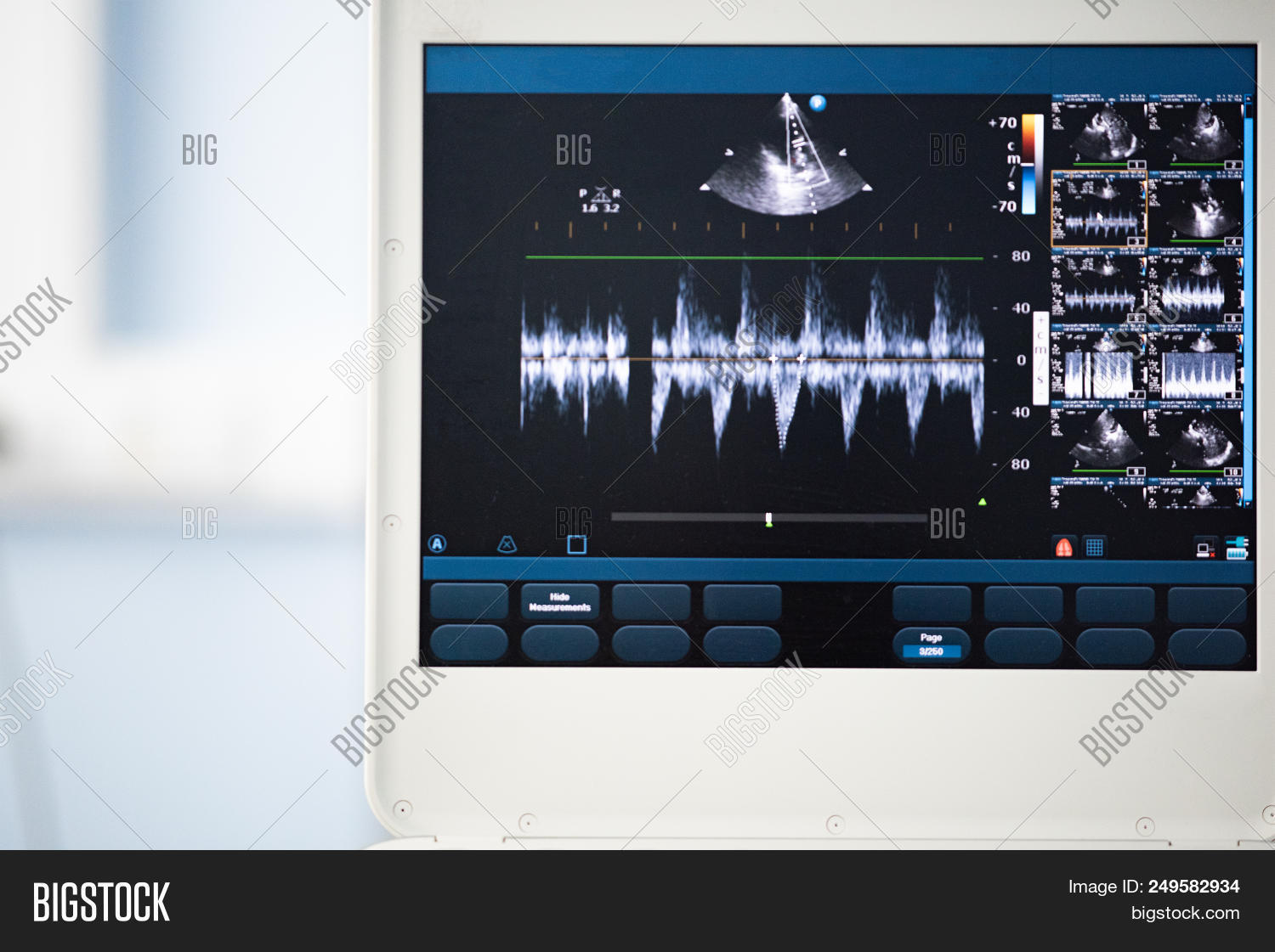 Ultrasound Screen Image & Photo (Free Trial) | Bigstock