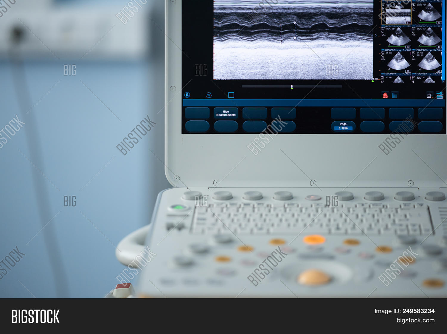 On Screen Ultrasound Image & Photo (Free Trial) | Bigstock