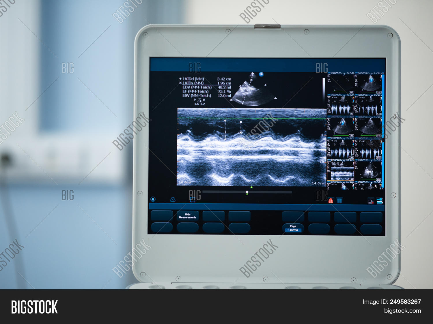 On Screen Ultrasound Image & Photo (Free Trial) | Bigstock