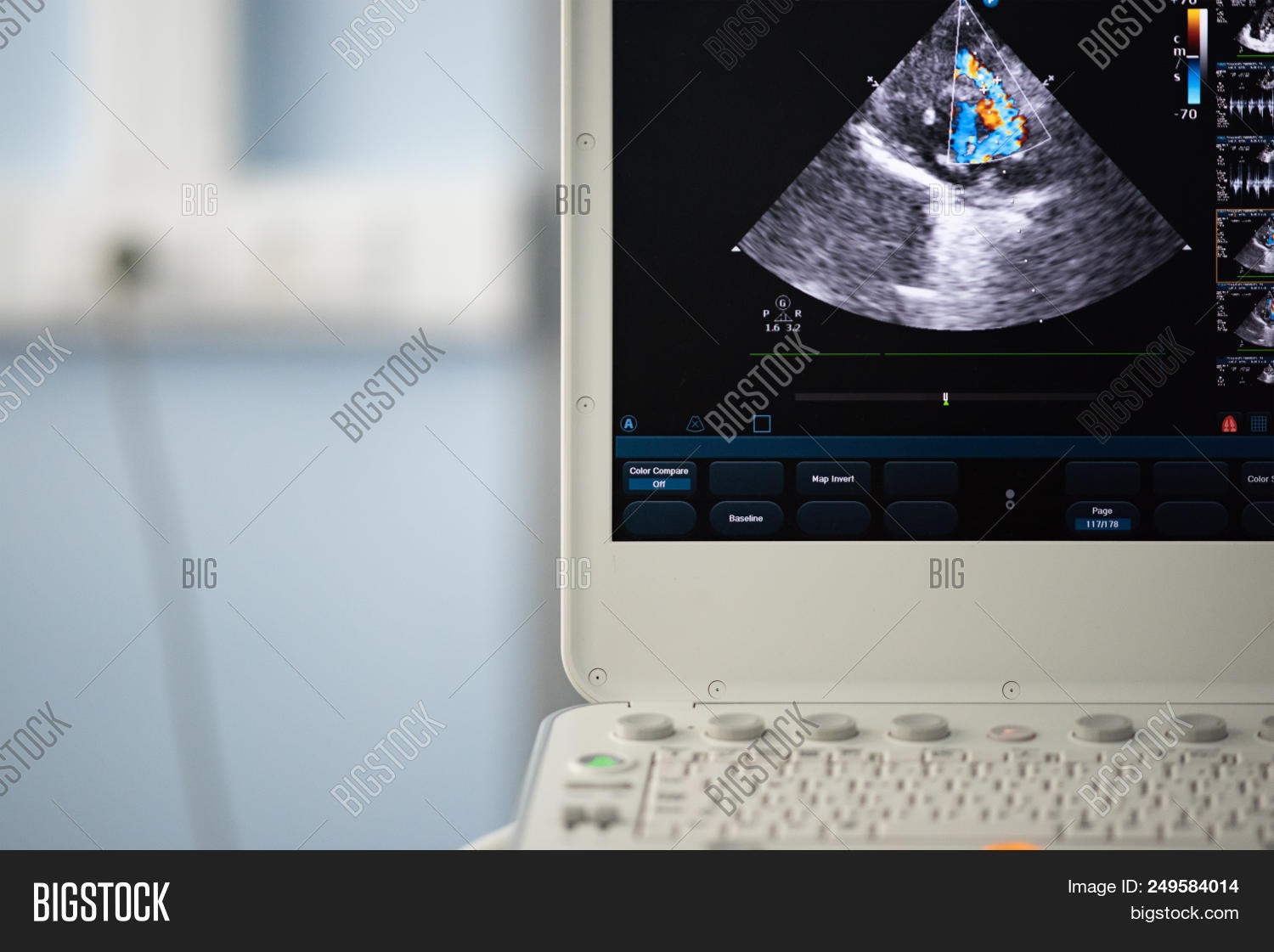 On Screen Ultrasound Image & Photo (Free Trial) | Bigstock