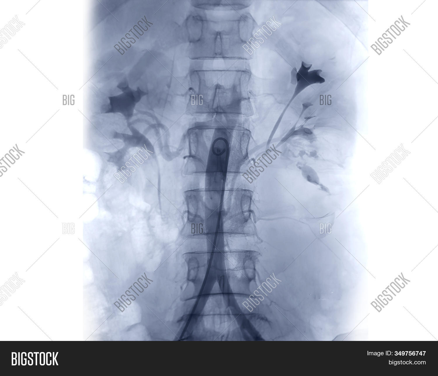 MRA Brain Neck Image & Photo (Free Trial) | Bigstock