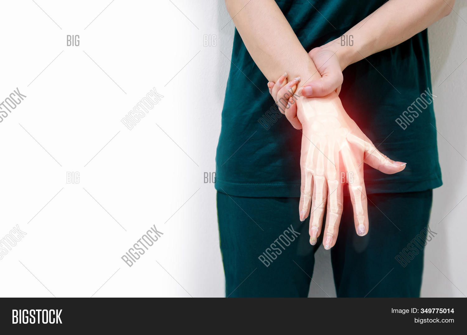Inflamed Hand Wrist Image & Photo (Free Trial) | Bigstock