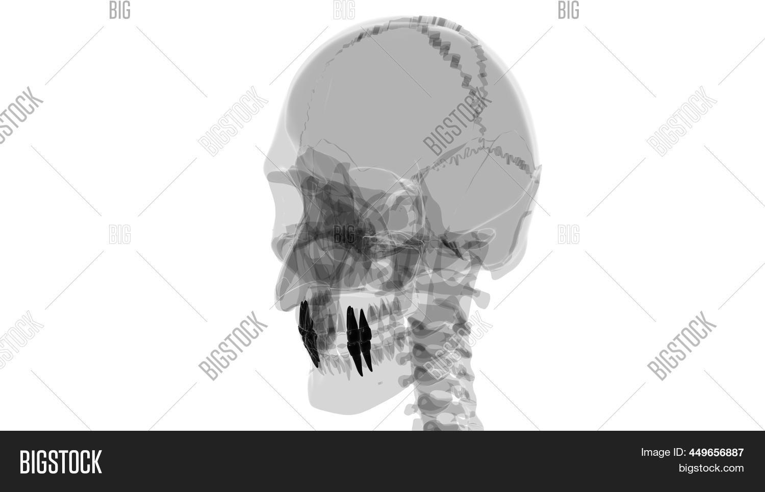 Human Teeth Premolars Image & Photo (Free Trial) | Bigstock