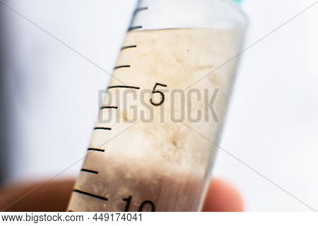 Liquid Culture Image & Photo (Free Trial) | Bigstock