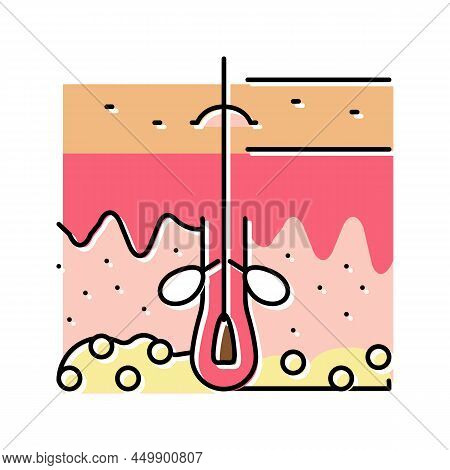 Sebum Skin Production Vector & Photo (Free Trial) | Bigstock