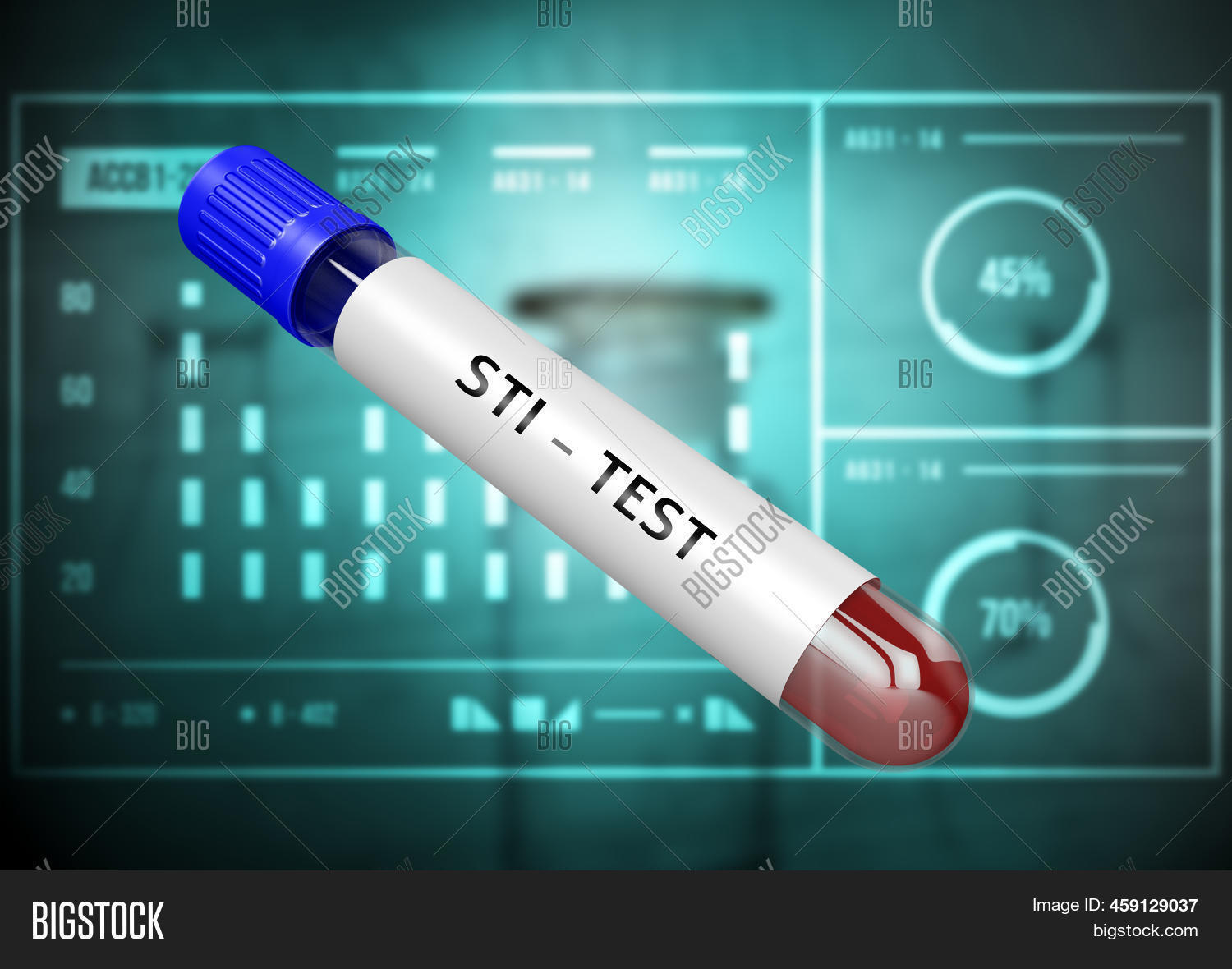 Tube Blood Sample Sti Image & Photo (Free Trial) | Bigstock