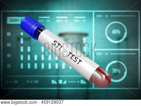 Tube Blood Sample Sti Image & Photo (Free Trial) | Bigstock