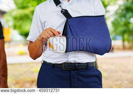 Man Broken Arm Cast. Image & Photo (Free Trial) | Bigstock