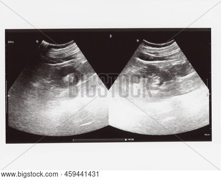 Full Abdomen Image & Photo (Free Trial) | Bigstock