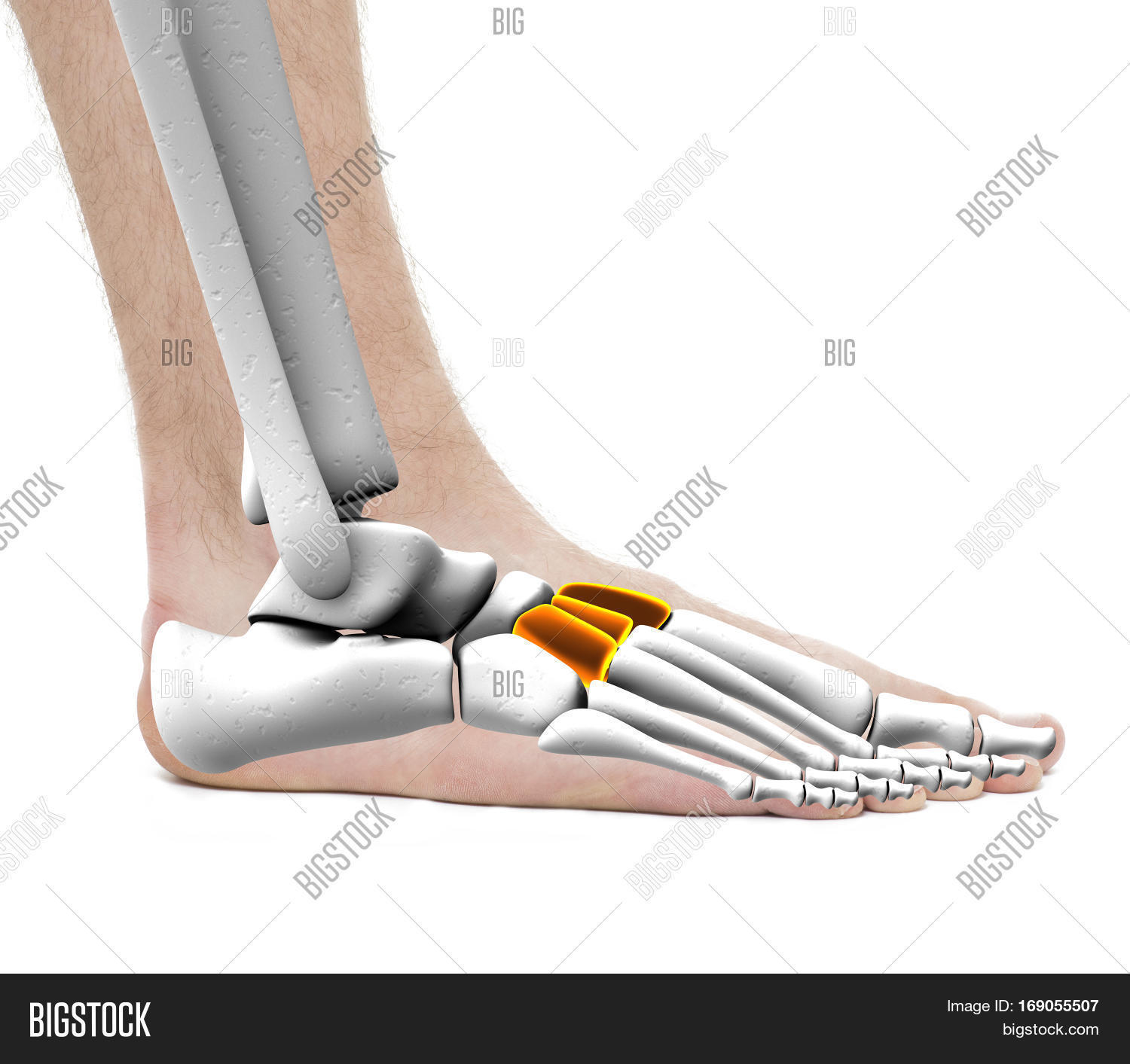 Cuneiform Bones - Image & Photo (Free Trial) | Bigstock