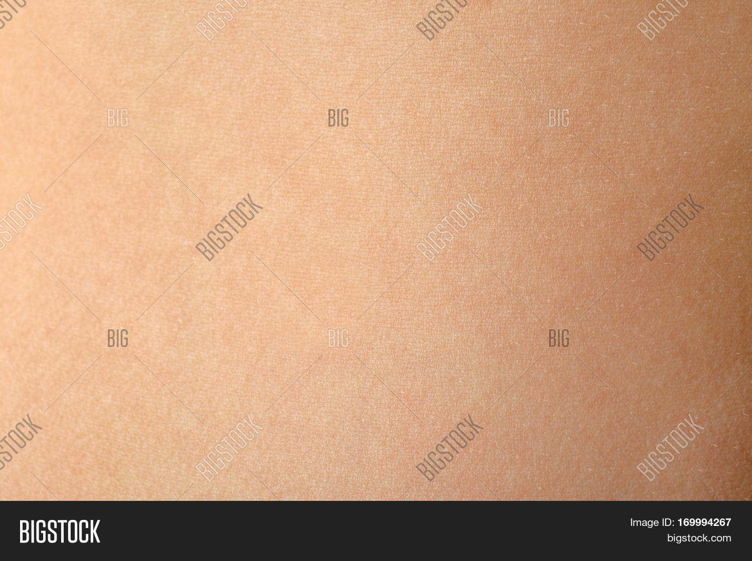 Texture Skin Image & Photo (Free Trial) | Bigstock